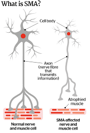 NEURODEGENERATIVE DISEASES